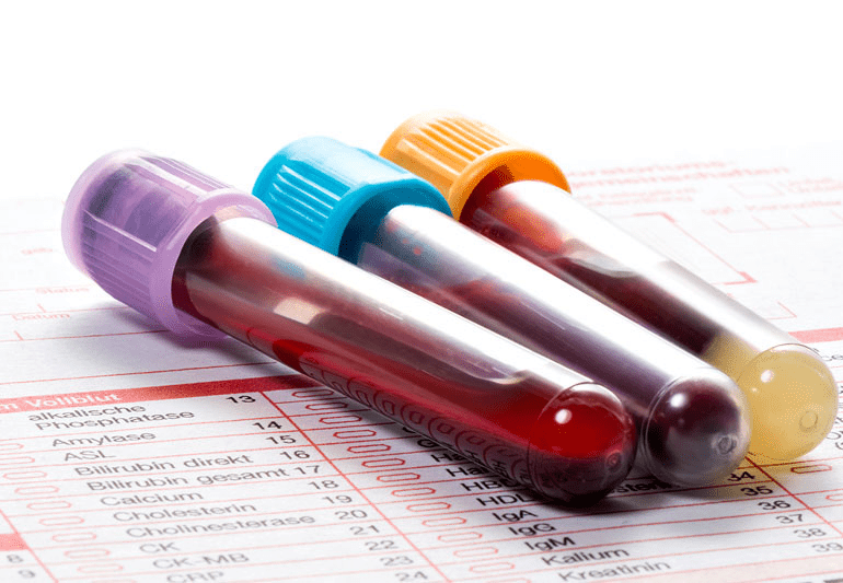 Bright Blood Red Is Good