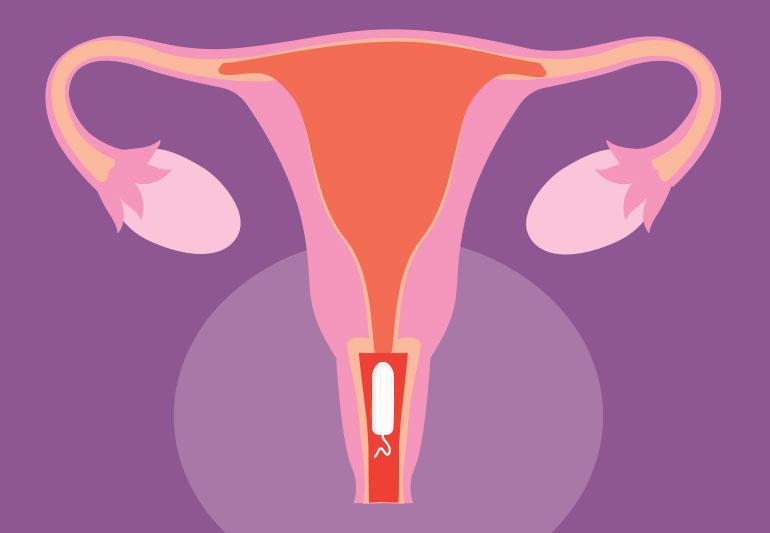 Tampon Instructions Diagram