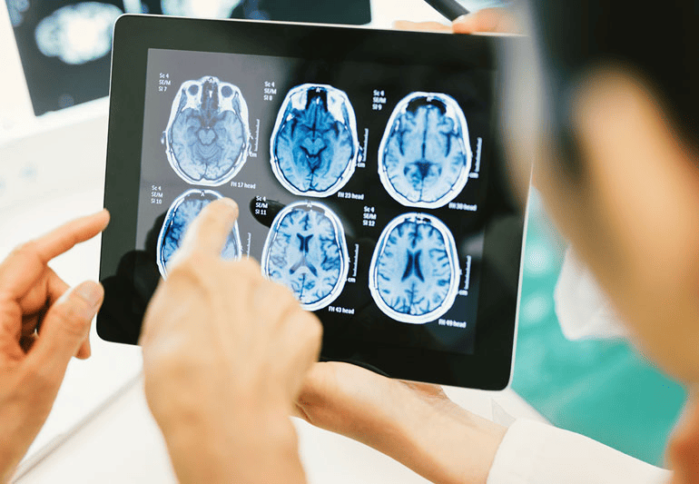 3 Ways To Treat A Mild Concussion The Tech Edvocate