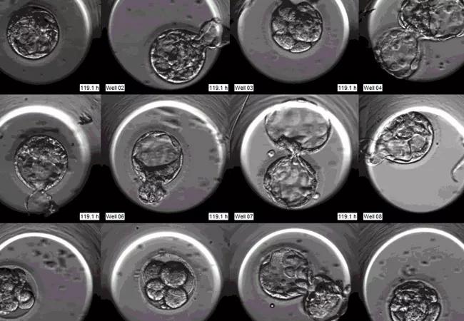 Microscopy Embryo Transfer Embryo Transfer