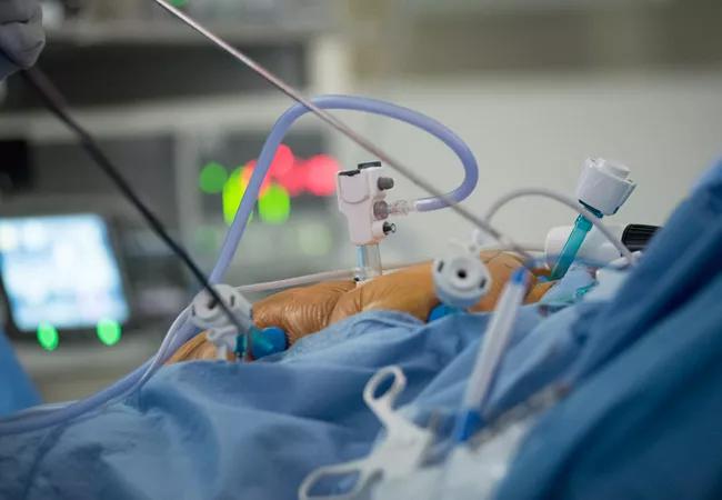 Minimally Invasive Approach to Intraperitoneal Chemotherapy for Ovarian ...