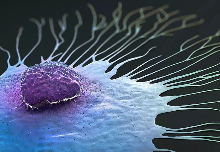 Breast Cancer Cells Under Microscope How Fast Does Breast Cancer