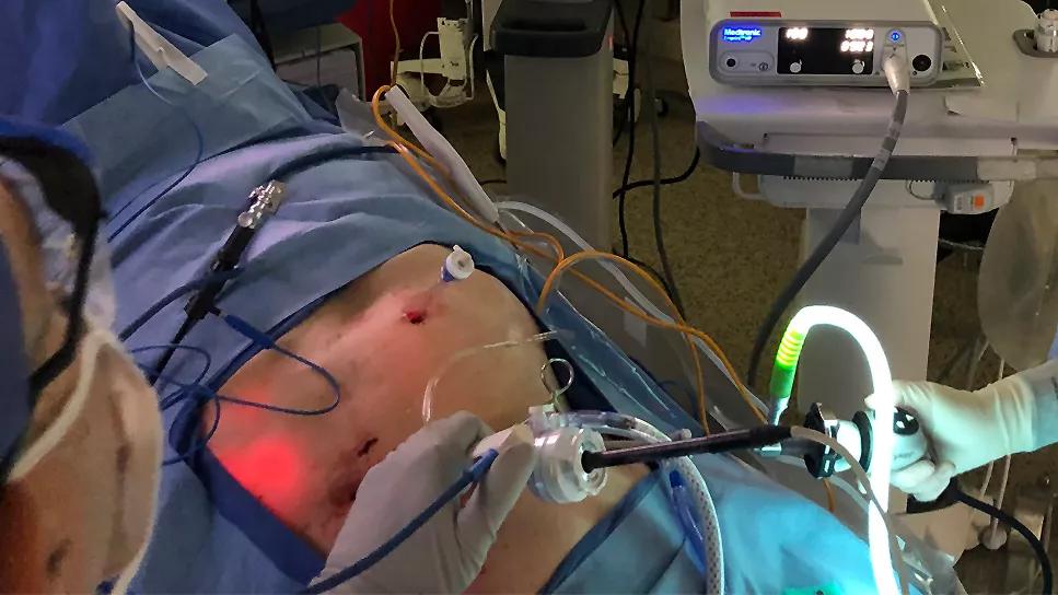 Fluorescence Imaging