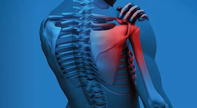 Empowering Patients to Tame Their Chronic Pain (Infographic)