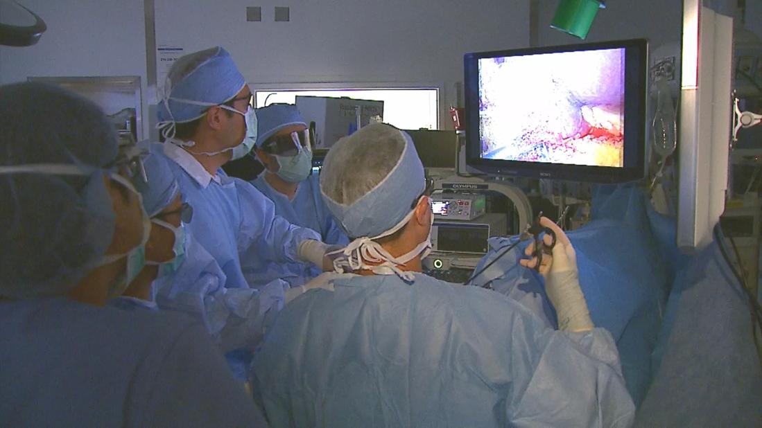 Cleveland Clinic Performs Its First Purely Laparoscopic Living Donor ...
