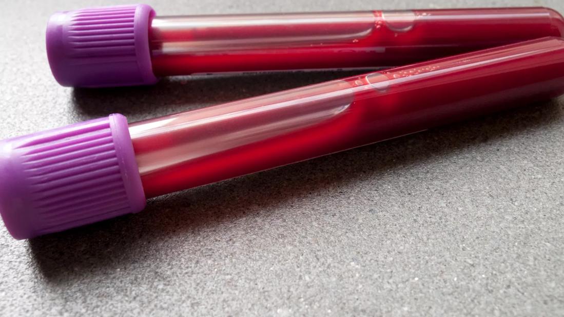 Researchers Find Common Measures of Immune Status, Inflammation Can ...