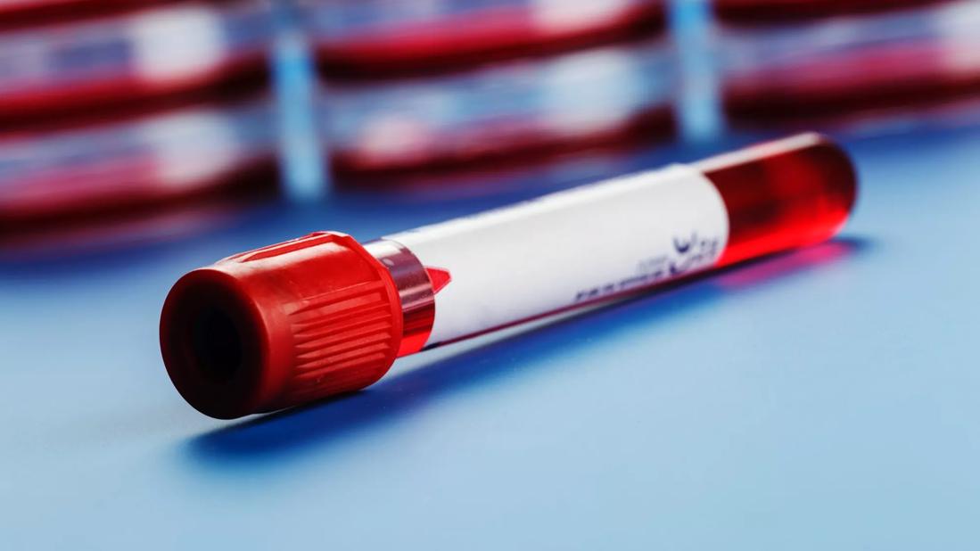 Cleveland Clinic-led Study Finds that More than 40 Percent of Prostate ...