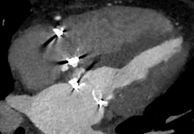 Images of Note: An Emerging Use of 4-D CT