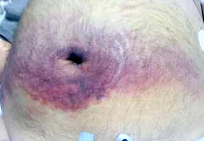 Images of Note: Grey Turner and Cullen Signs