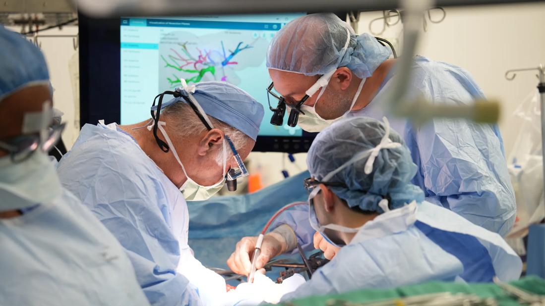 Heart-Transplant-Milestones_2_CCF-JPG