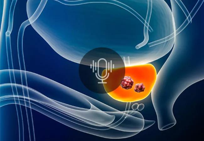 Exploring Focal Therapies for Prostate Cancer (Podcast)