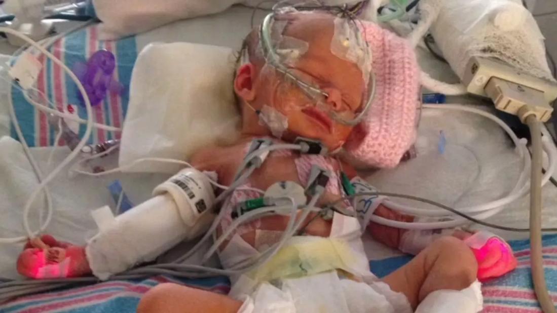 Mother’s Intuition Saves Baby Girl