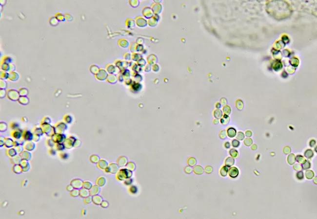 Urinary Tract Infection Bacteria Microscope