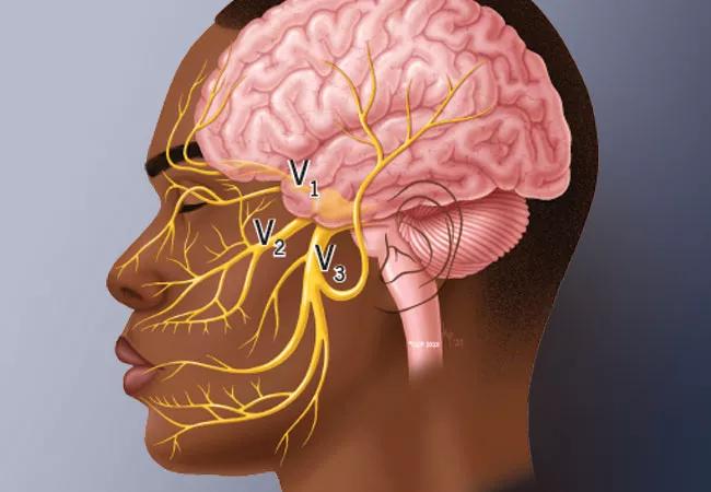 Trigeminal Nerve Brain Mapping The Body: Trigeminal Nerve | Health